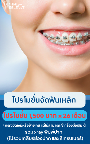 dental-select – คลินิกทันตกรรมครบวงจร